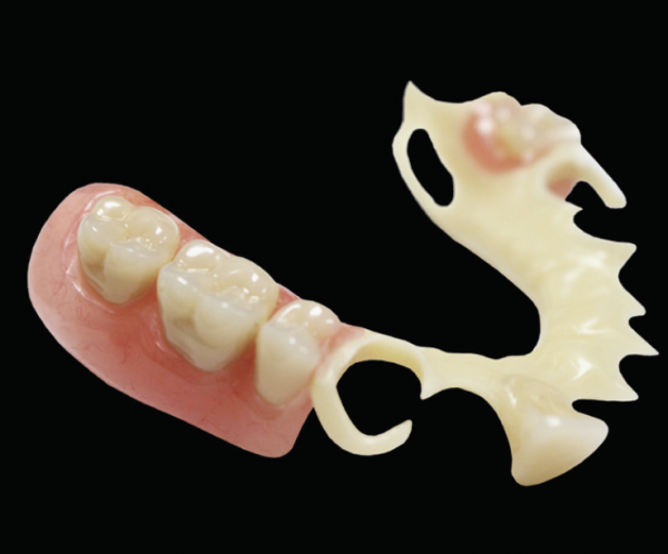 Removable Partial Dentures - Ottawa Dental Laboratory LLC