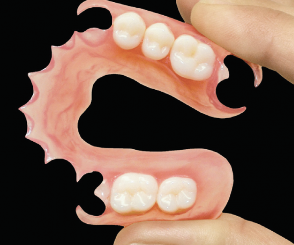 Removable Partial Dentures - Ottawa Dental Laboratory LLC